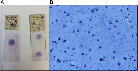 Plasmodium Slide Labeled