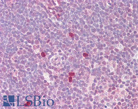 Pathplus™ Myc C Myc Polyclonal Antibody Rabbit Anti Human Lsbio