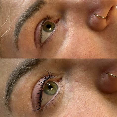 Fennec Den Esthetics Inc Lethbridge Ab