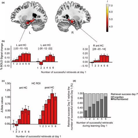 A D Linear Parametric Modulation Effects From The Whole‐brain Download Scientific Diagram