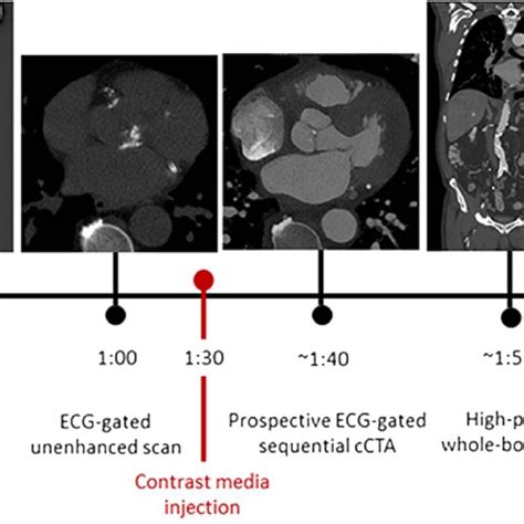 Computed Tomography Ct Imaging Protocol Timeline Illustrating The Download Scientific