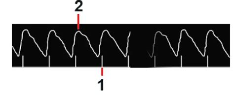 Masimo W1 Advanced Health Tracking Watch User Guide