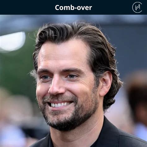 20 Best Mens Haircuts For Balding Hair How To Hide Your Hair Loss