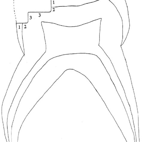 Grading system used to assess dye penetration Grade 0 ¼ no dye Download Scientific Diagram