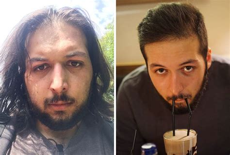 People Who Used To Be Ugly Ducklings” Share Their Transformations And