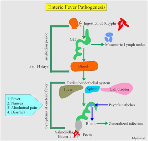 Typhoid Fever Enteric Fever Salmonella Typhi