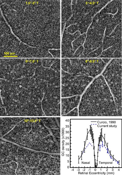 En Face Images Extracted From Gcl At Increasing Retinal Eccentricity Of