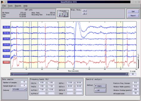 User Interface Of Quantitative Eeg Analysis Tool Download Scientific
