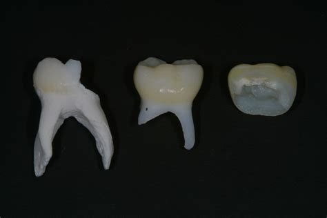 Fotogalerie Mléčné Zuby Mnohem Větší Než Si Laik Představuje Vitalia Cz
