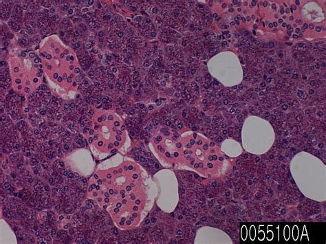 Parotid Gland Normal Xelonet