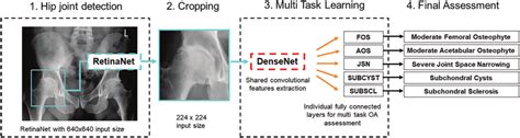 Deep Learning Architecture Overview First Step A RetinaNet Was Download Scientific