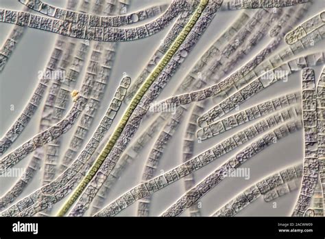 Light Micrograph Of Cyanobacteria Filaments Planktothrix Rubescens And
