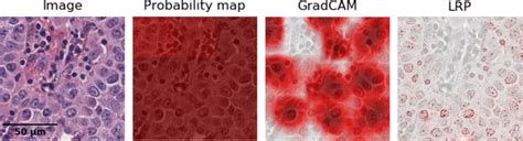 Different Granularity Levels Of Visual Explanations—from Patch Level