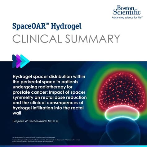 Tim Watson Posted On Linkedin