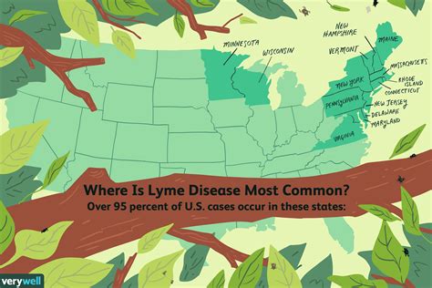 Lyme Disease History At Spencer Boland Blog