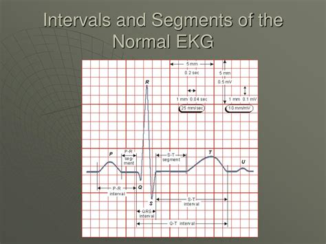 Ppt The Physiological Basis Of The Ekg Powerpoint Presentation Free