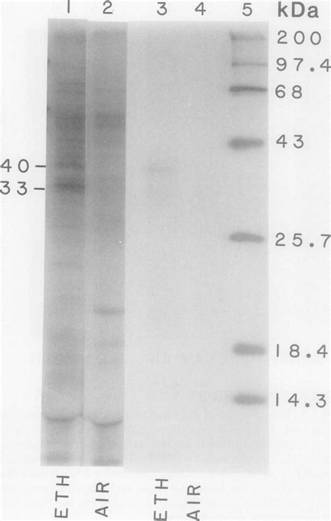 Composite From Autoradiogram Of An In Vitro Translation And Subsequent