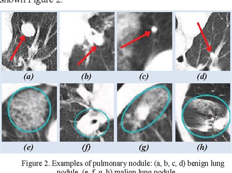 Figure 2 From Artificial Neural Network Based Classification System For