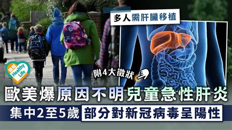 世衛警戒︳歐美爆發原因不明兒童急性肝炎 集中2至5歲部分對新冠病毒呈陽性︳附4大徵狀
