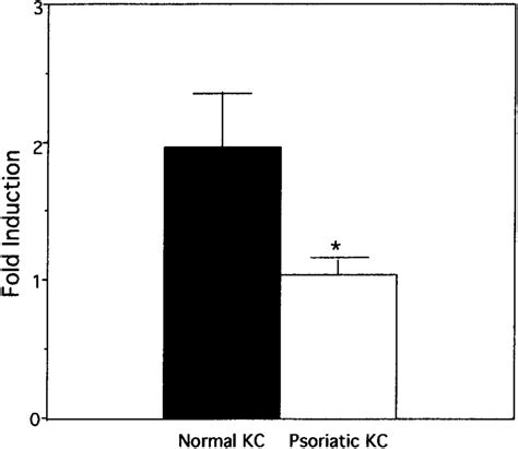 Reduction In Irf 1 Induction 5 H After The Addition Of 30 Iuml Ifn 30