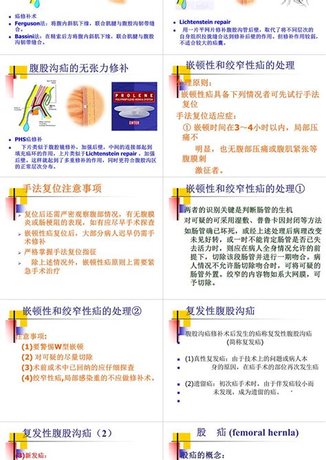 外科学 腹外疝ppt模板 卡卡办公