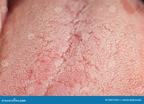 Human Tongue Texture Royalty Free Stock Image 28622740