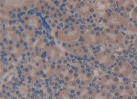Complement C4 Polyclonal Antibody Invitrogen 20 μl Unconjugated