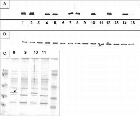 Analysis Of Outer Membrane Proteins In Klebsiella Pneumoniae A Download Scientific Diagram