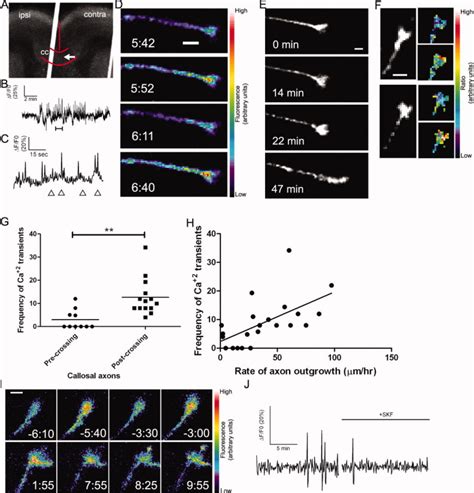 Callosal Axons Express Spontaneous Calcium Transients That Are Download Scientific Diagram