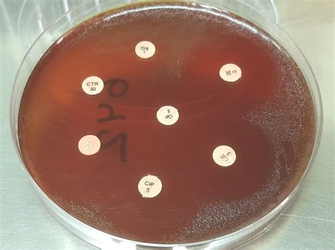 Streptococcus Sanguinis Introduction Morphology Pathogenicity Lab