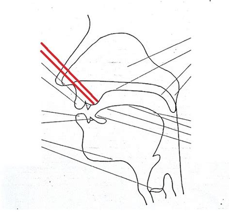 Les Organes De La Phonation Classification Physical Flashcards Quizlet