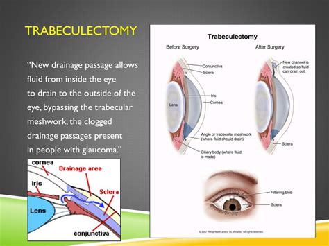 Ppt Icd 10 Cm And Icd 10 Pcs Coding Scenarios Powerpoint Presentation Id 3552281