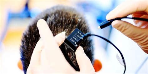 Ai Powered Brain Implants Help Paralyzed Patients Communicate Faster Than Ever By Parsing The