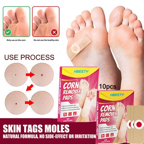 10pcs Box Warts Remover Patch Skin Tag Remover Patch Warts Remover Plaster Wart Treatment Patch