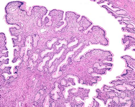 Human Endocervix Photograph By Jose Calvoscience Photo Library Fine