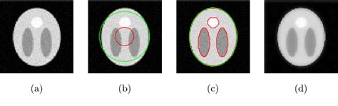 Figure 2 From Efficient Active Contour Model For Multiphase