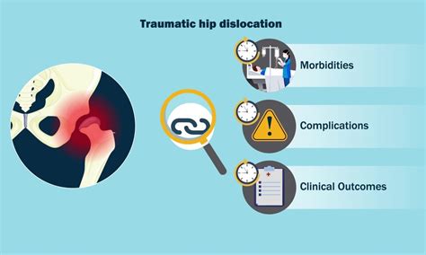 Video Abstract Traumatic Hip Dislocations Orthobuzz