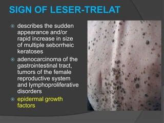 Cutaneous Menifestion Of Internal Malignancy Pptx
