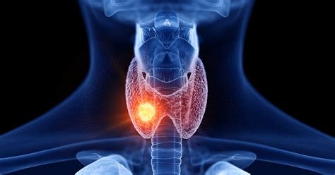 40 Facts About Hashimoto