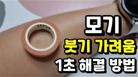 모기 물린곳 붓기 가려움 1초만에 해결이 가능합니다 Youtube