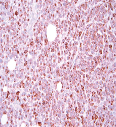 Surgical Neurology International