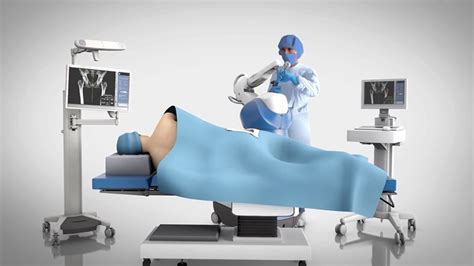 Robotic Total Hip Replacement Surgery Knee Shoulder And Hip Surgeon Orthopaedic Surgery
