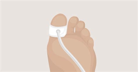 Toe Pressures Huntleigh Healthcare