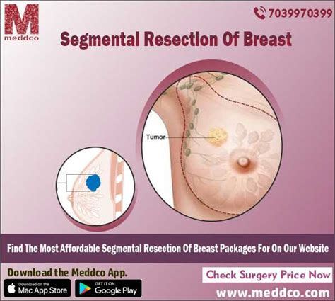 Brief Introduction To Segmental Resection Of Breast