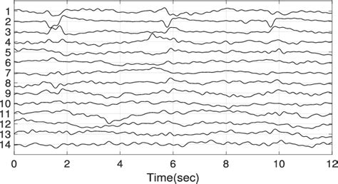 Figure 12 From Ocular Artifacts Elimination From Multivariate Eeg Signal Using Frequency Spatial