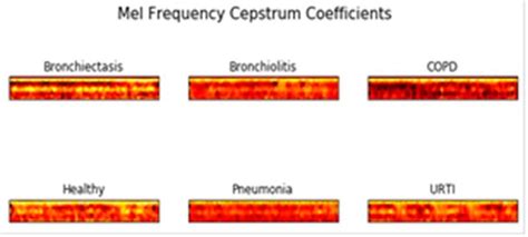 Mel Frequency Cepstral Coefficients Of Diseases Download Scientific Diagram