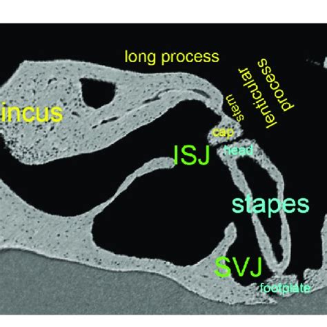A Finite Element Model Fem Of The Middle And Inner Ear Developed