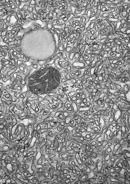 Tubules Of Endoplasmic Reticulum Tem Stock Image Science Source Images