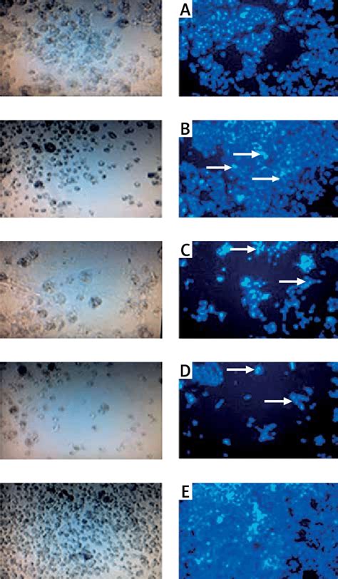 Photographic Record Of Dapi Stained Apoptotic Cells After Plasma