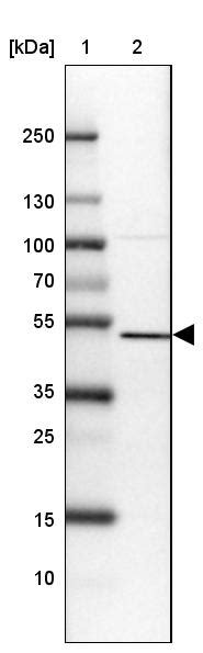 Rabbit Polyclonal Anti Setd7 Antibody Buy For Research Highly